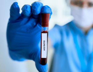 A/G Ratio - Al Thiqa Pharmacy